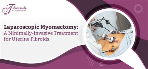 Laparoscopic Myomectomy A Minimally Invasive Treatment For Uterine