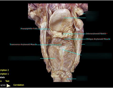 Face Infratemporal Fossa Image 17 Exam 1 Diagram Quizlet