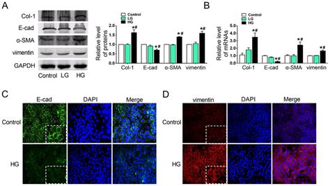 Hg Induces Epithelial Mesenchymal Transition In Aml12 Cells A