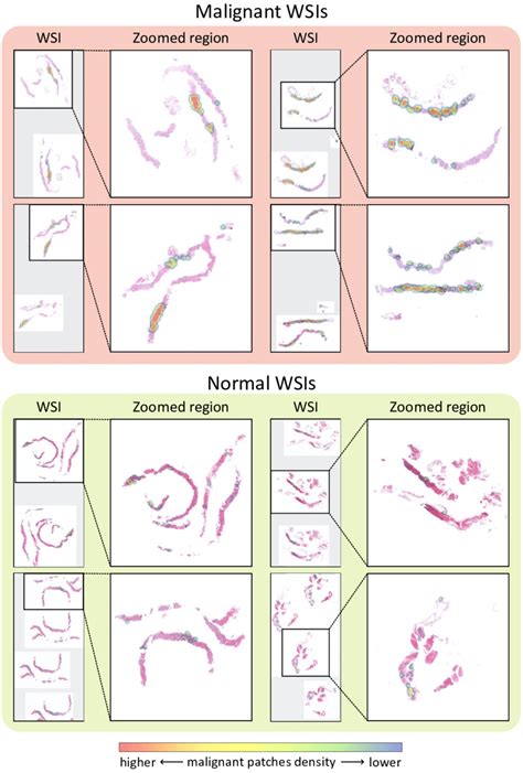 Eight Different Wsi Samples Extracted From The Dataset Presented In