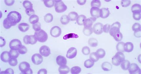 Malaria Cell Atlas Tracks Parasite Activity With Single Cell Transcriptomes Genomeweb