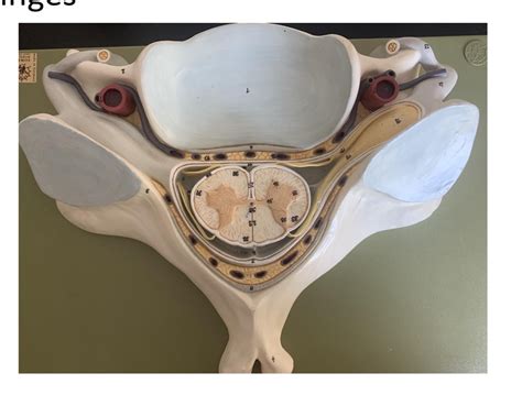ANATOMY LAB PRACTICAL CROSS SECTION OF A SPINAL CORD Diagram Quizlet