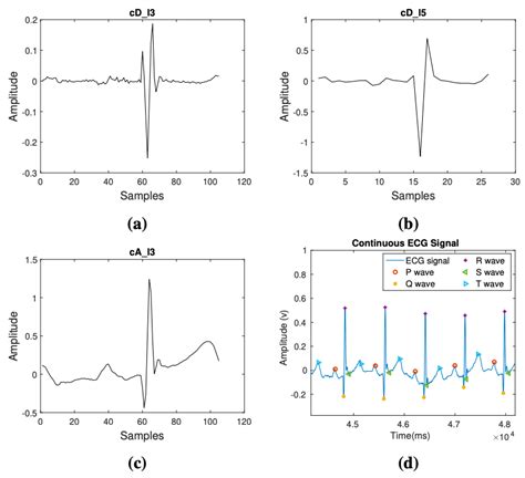 Accurate Fiducial Point Detection Using Haar Wavelet For Beat By Beat
