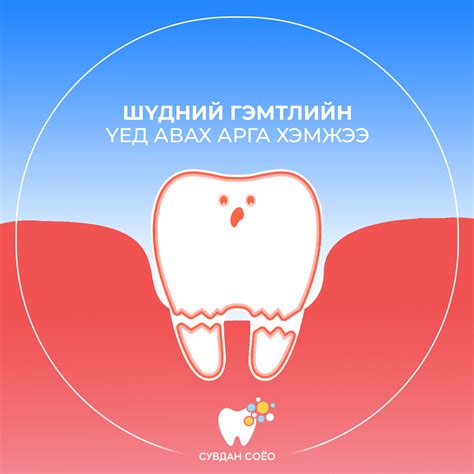 Шүдний гэмтлийн үед ямар арга Сувдан соёо шүдний эмнэлэг