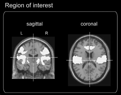 Region Of Interest Are Marked In White Including The S1 OP 1 4 Download Scientific Diagram