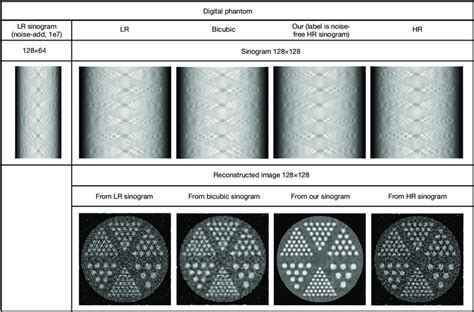Noise Added Sinogram And Reconstructed Image Obtained Using Different Download Scientific
