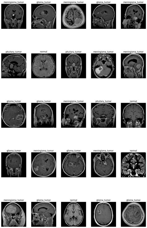 Github Mojtabazarrehbrain Tumors Classification Brain Image Classification With Cnn