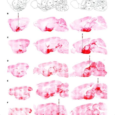 Retrograde Tracing Orexin Fibers Orexin Cre Mice Received Retrograde