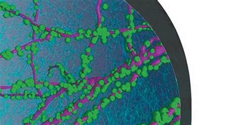 3d 뇌스캔 기술신경망 매핑 기술 뇌지도 만들기 속도 낸다