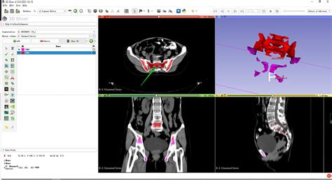 标签转化DICOM格式后与原先标签不一致 问题求助 DSlicer中文论坛