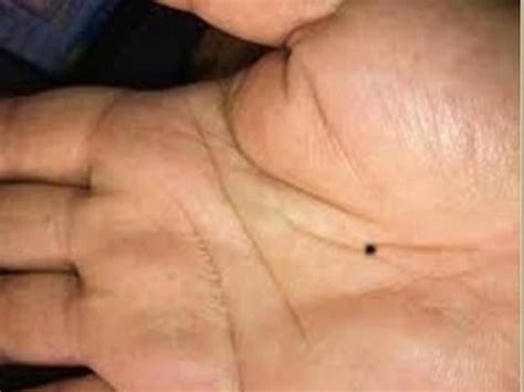 Hast Rekha Shastra Do You Also Have Mole In Your Palm Know Whether It Is Auspicious Or