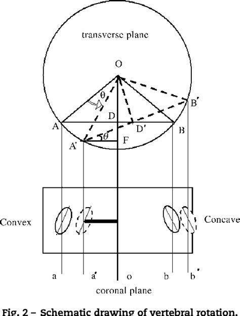 Figure 2 From Vertebral Axial Rotation Measurement Method Semantic Scholar