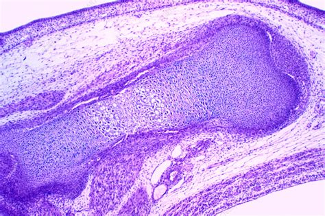 Long Bone Ossification Light Micrograph Stock Image C062 0276 Science Photo Library