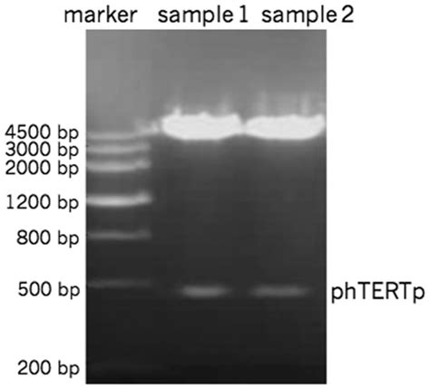 Phtertp Luc And Pgl4 17 Luc2 Neo Were Separately Digested With Download Scientific Diagram