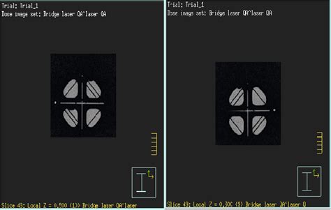 Left QA Phantom Was Scanned With Head First Supine With MRI Marker On Download Scientific