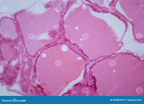 Thyroid Gland Under A Microscope Light Micrograph Exhibiting Typical