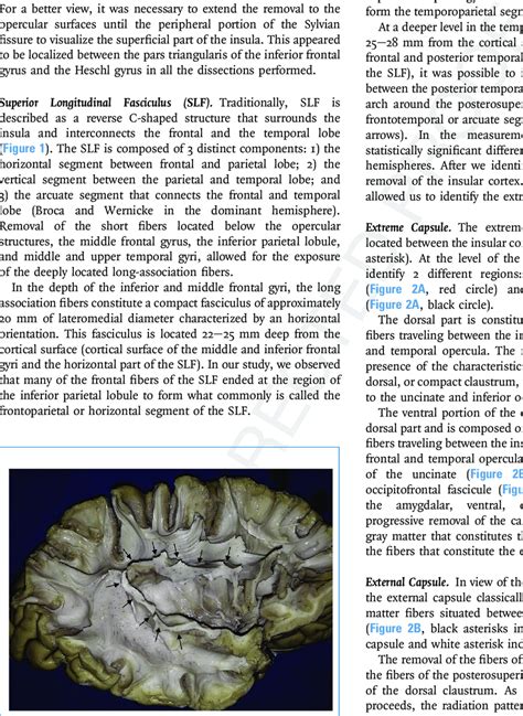 The Superior Longitudinal Fasciculus Slf Is Composed By A Horizontal Download Scientific