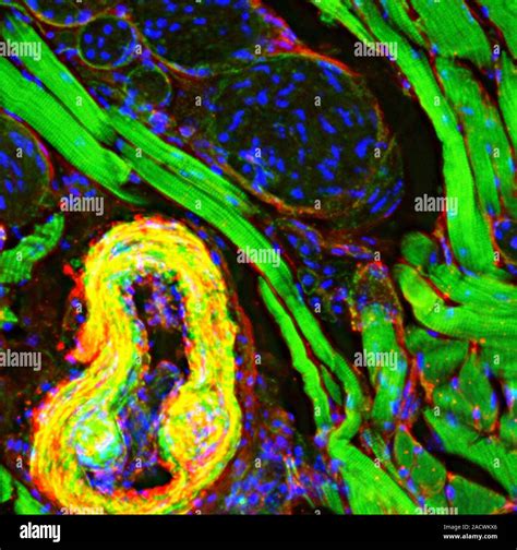 Tongue Tissue Fluorescence Deconvolution Micrograph Of A Section Through Tongue Tissue Showing