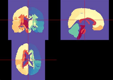 Chapter 3 Data Wrangling Applications Of R In Healthcare