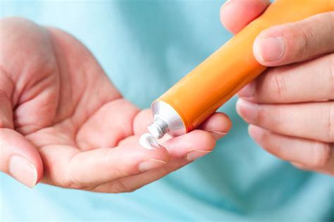 여자의 손 그녀는 스테로이드를 사용 하 여 외부 유형을 적용 연고에 대한 스톡 사진 및 기타 이미지 연고 보습제 크림색 Istock