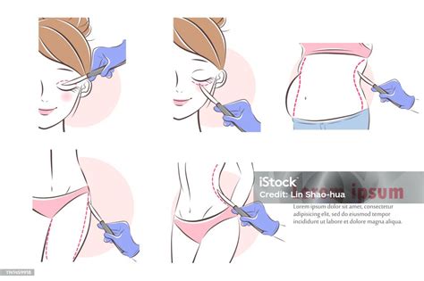 성형 수술에 대 한 여자 가꿔주기에 대한 스톡 벡터 아트 및 기타 이미지 가꿔주기 가냘픈 건강 검진 결과 Istock