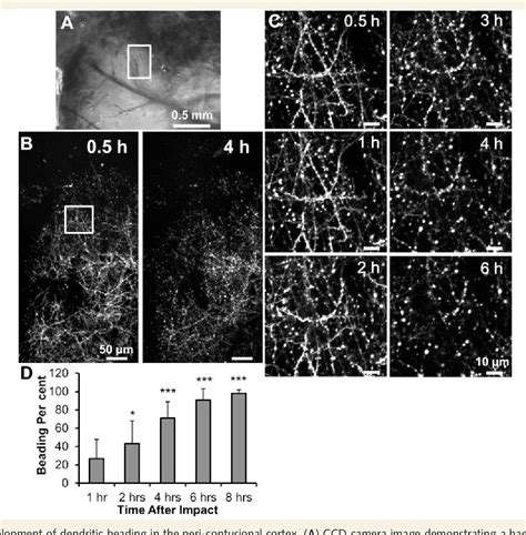 Figure 3 From Evolution Of Neuronal And Astroglial Disruption In The