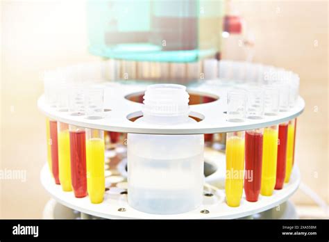 Professional Laboratory Sample Processor Pump Automation In Ion