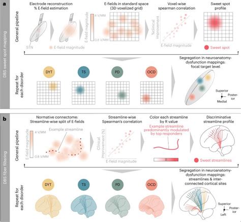 University Of Pittsburgh Neurosurgery On Linkedin Mapping Dysfunctional Circuits In The Frontal