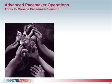 Ppt Pacemaker Automatic Features Module 10 Powerpoint Presentation