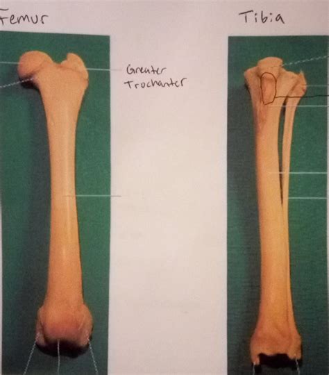 Femur Tibia Diagram Quizlet