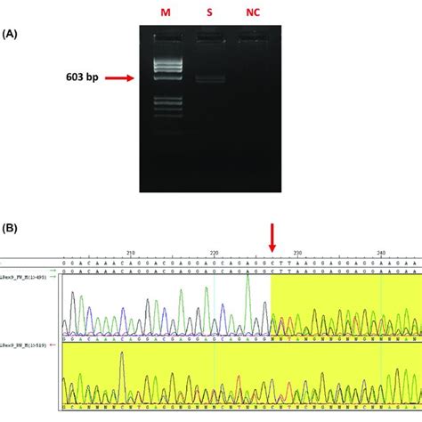 Calr Mutation Identified In The Analysed Athlete A Agarose Gel Download Scientific Diagram