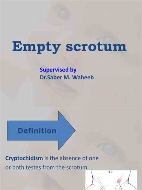Pdf Empty Scrotum Dokumen Tips