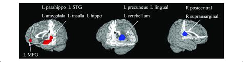 The Areas Of Increased Red And Decreased Blue Resting State Download Scientific Diagram