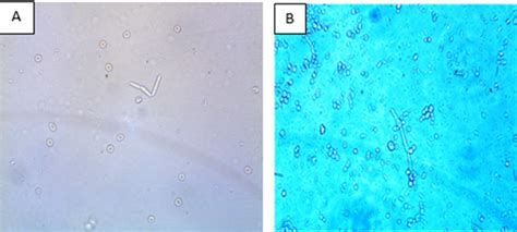 Extracellular Hydrolytic Enzyme Production By D Capitatus A Download Scientific Diagram