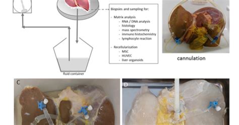 Building A New Liver From Matrix And Human Stem Cells Health~holland