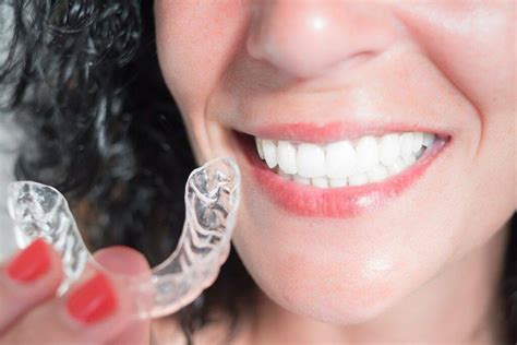 Innovating Comfort The Evolution Of Clear Aligner Materials By Odonto