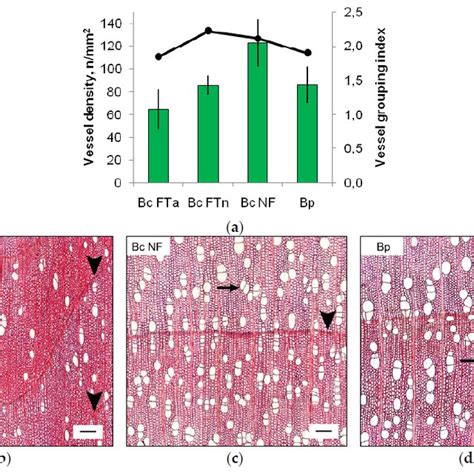 Parameters And Appearance Of Xylem Tissue In Sampled Birch Trees A