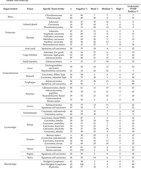 Table 1 From Thioredoxin Interacting Protein Txnip Is Differentially Expressed In Human Tumor