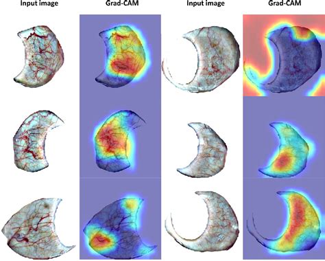 Figure 5 From Deep Learning Algorithm For Automated Detection Of Polycystic Ovary Syndrome Using