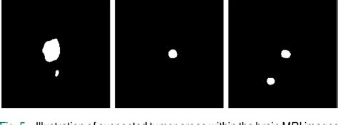 Figure 5 From Novel Robust Automatic Brain Tumor Detection And