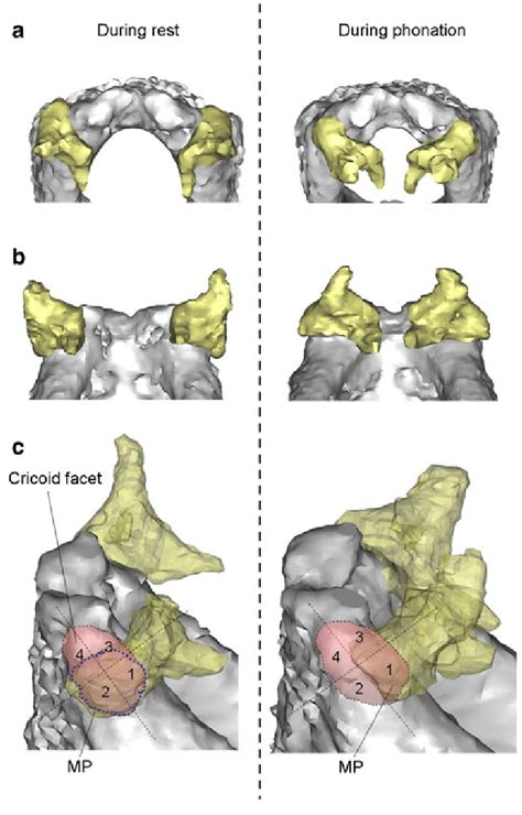Arytenoid Cartilage Muscular Process