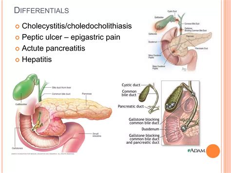 Ascending Cholangitis Case Presentation PPTX
