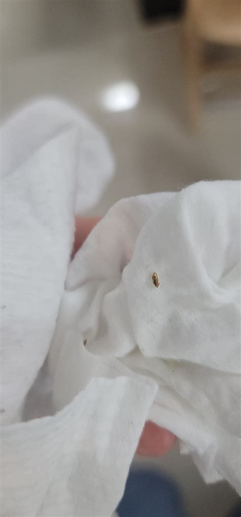 쓰레기통 근처에 이렇게 깨처럼 생긴 지식in