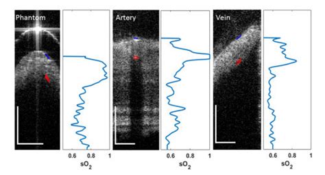 Enlarged B Scans Marked With The Identified Voxels Blue Anterior Download Scientific Diagram