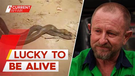 How A Snake Catcher Survived Another Bite