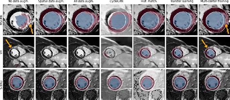 Figure 1 From Domain Generalization In Deep Learning For Contrast Enhanced Imaging Semantic