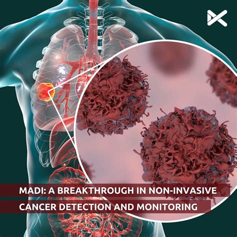 Sowmya Reddy Posted On Linkedin