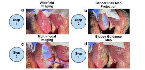 The Active Biopsy Guidance Sys [image] Eurekalert Science News Releases