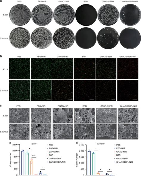 Photothermal Sensitive Nanocomposite Hydrogel For Infectious Bone Defects Pmc