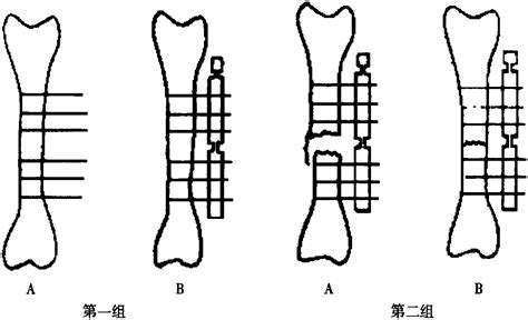 一实验分析方法 骨科框架固定学 医学